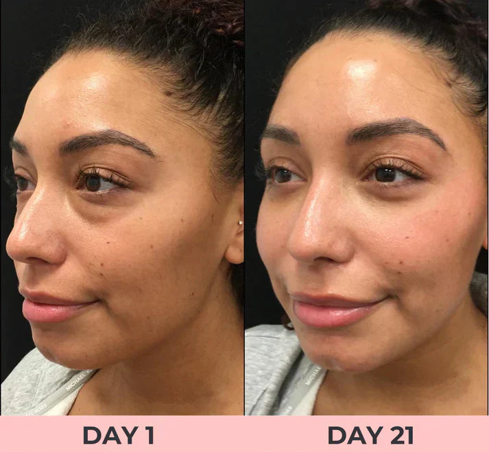 3D Red Light EMS Eye Massager Glasses – Luxurella.com